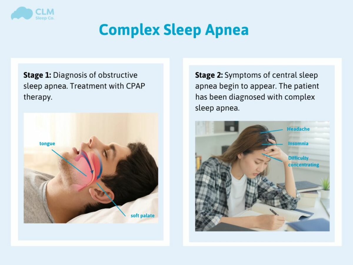 Sleep Apnea Education Materials