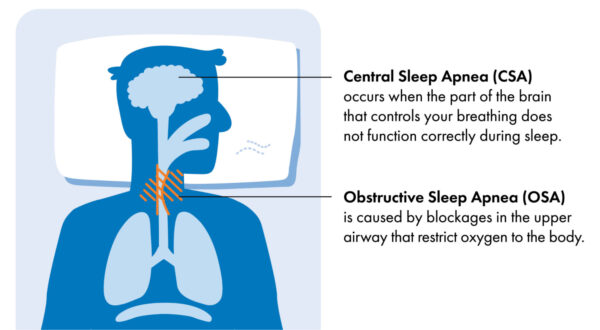 Sleep Apnea Symptoms in Australia: When to See a Sleep Specialist