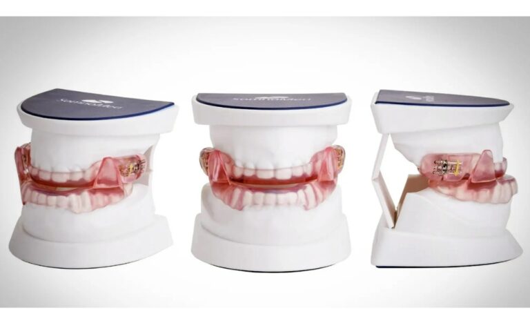 Sleep Apnea Mouth Guard: Effective Treatment for Better Sleep