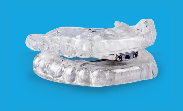 Sleep Apnea Mouth Guard: Effective Treatment for Better Sleep