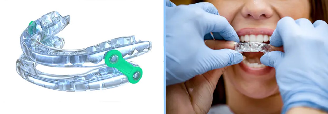 Effective Snoring Mouth Guard Solutions for Peaceful Sleep