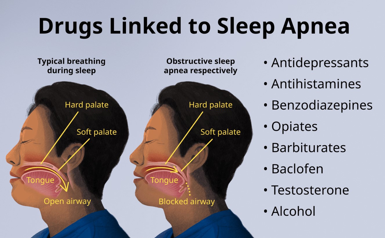 Why Do People Snore? Common Causes and Solutions Explained