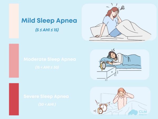 Mild Sleep Apnea: What it is, Signs, Causes and Treatments