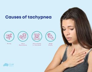 Tachypnea: Symptoms, Causes and Treatment - CLM Sleep