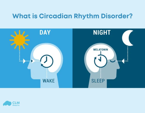 Circadian Rhythm Disorder: Causes, Symptoms, and Treatment