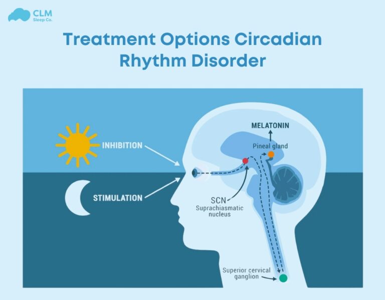Circadian Rhythm Disorder: Causes, Symptoms, and Treatment