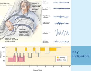 Comprehensive Sleep Study Results: Key Insights