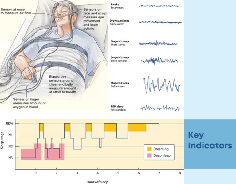 Comprehensive Sleep Study Results: Key Insights