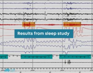 Comprehensive Sleep Study Results: Key Insights