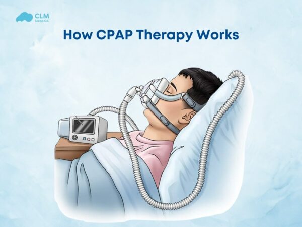 Do You Need a CPAP Machine for Mild Sleep Apnea? | CLM Sleep